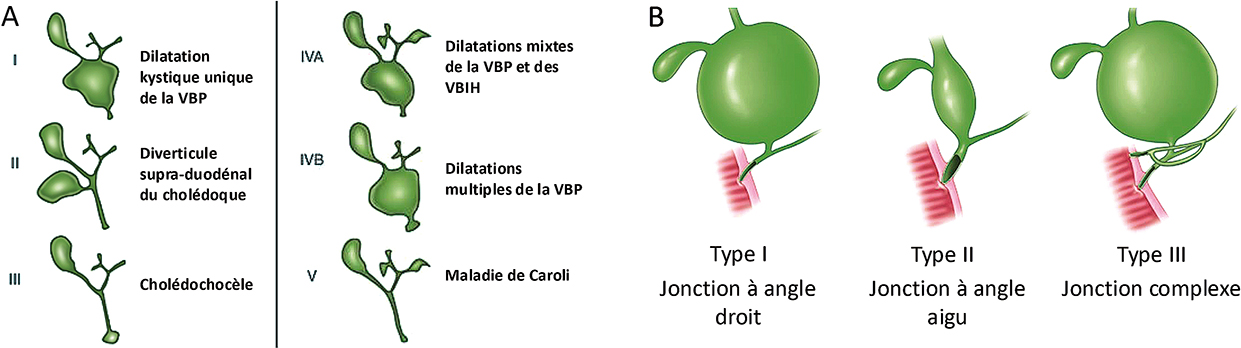 Diagnostic et prise en charge des anomalies anatomiques des voies ...